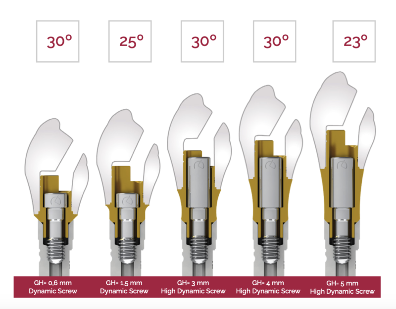 Implants and Abutments - Next Day Dental Implants - Dynamic Dental ...